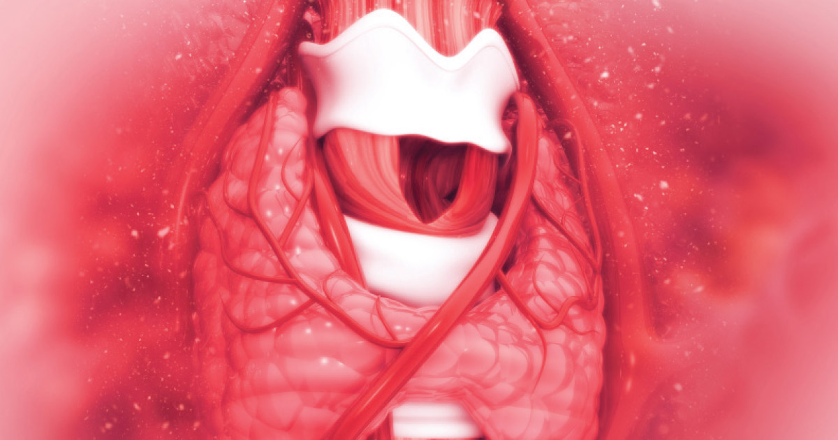 RACGP - Thyroid disease Long term management of hyperthyroidism and hypothyroidism