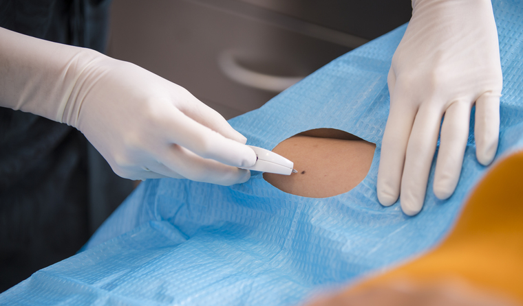 RACGP - RACGP calls for ‘more action’ following reproductive healthcare ...