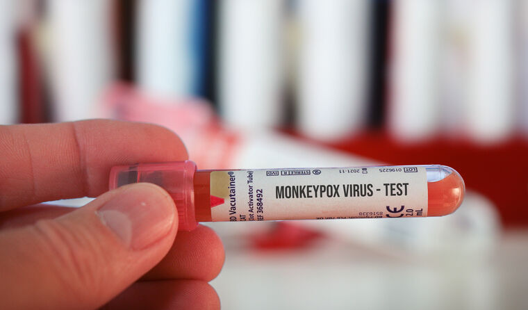 RACGP - Monkeypox declared global health emergency as WHO pushes ...