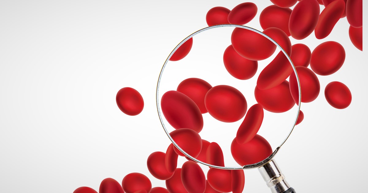 RACGP - ‘Huge advances’ in iron deficiency lead to new clinical guidance