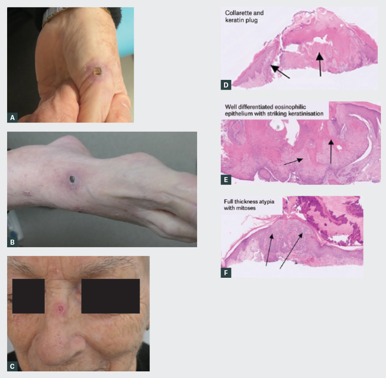 RACGP - AJGP (Australian Journal of General Practice)