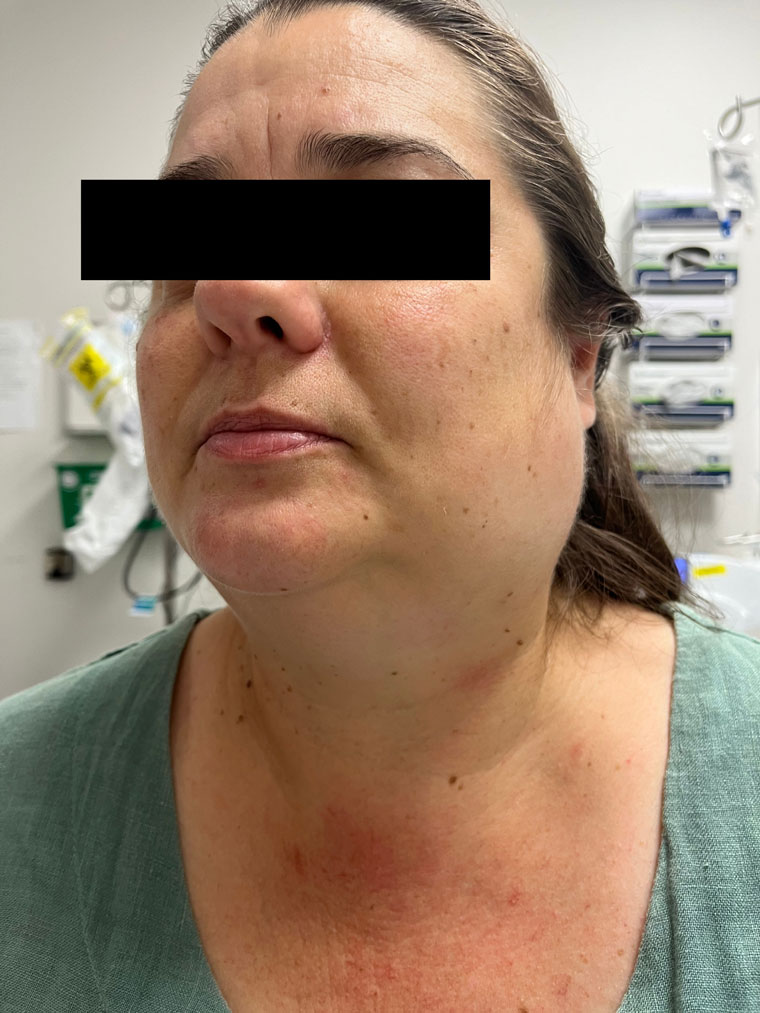 RACGP - AJGP (Australian Journal of General Practice)