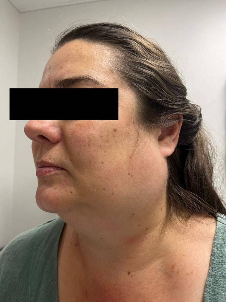 RACGP - AJGP (Australian Journal of General Practice)