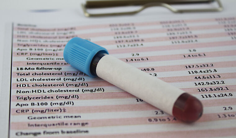 Some specialists say screening is needed to detect ‘bad cholesterol ...