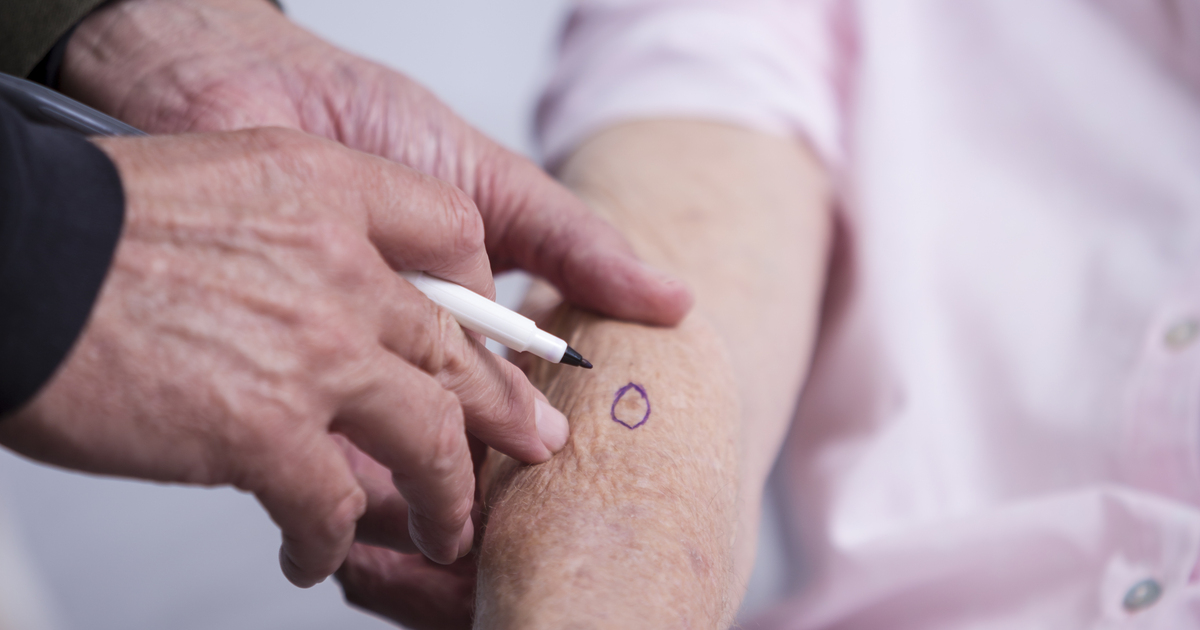 RACGP - Breakthrough in mRNA vaccines for melanoma