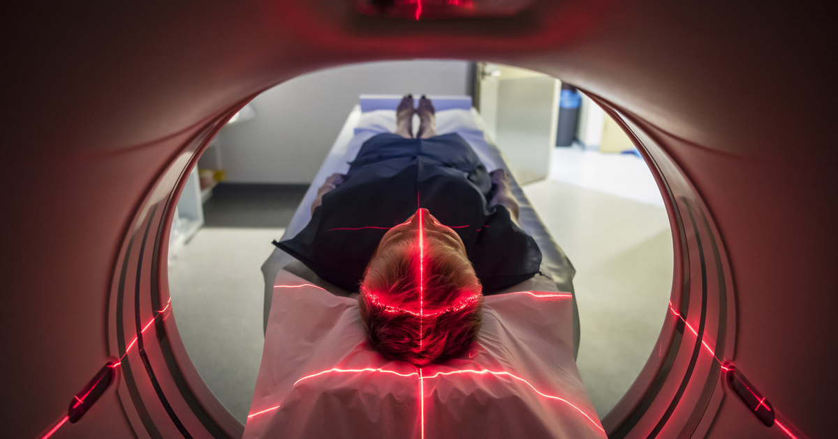 RACGP - Study reveals clearer picture of hypertension’s impact on brain ...