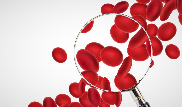 RACGP - ‘Huge advances’ in iron deficiency lead to new clinical guidance