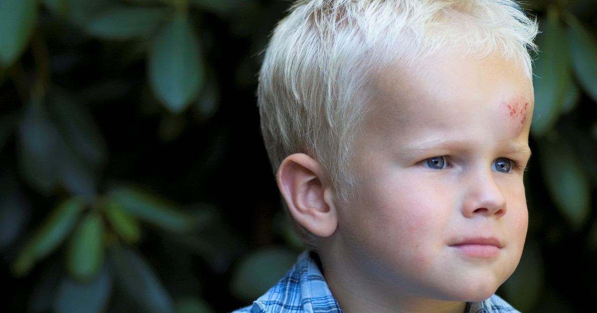 RACGP - First-ever head injury guidelines for children