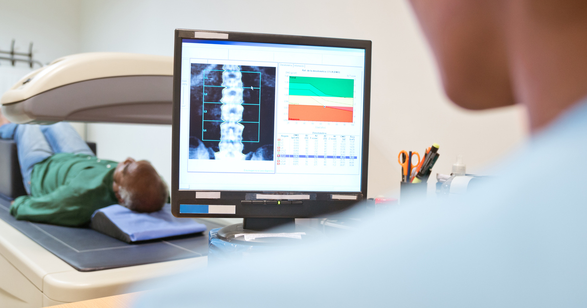 RACGP - Osteoporosis guidelines updated for first time since 2017