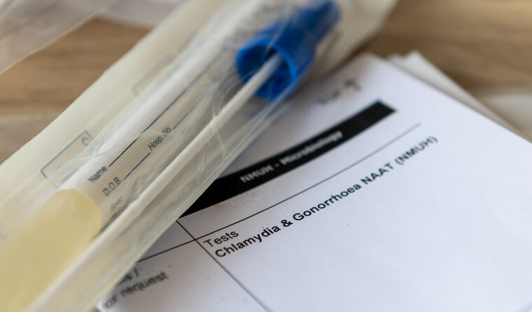 RACGP - Common STIs surge among young people